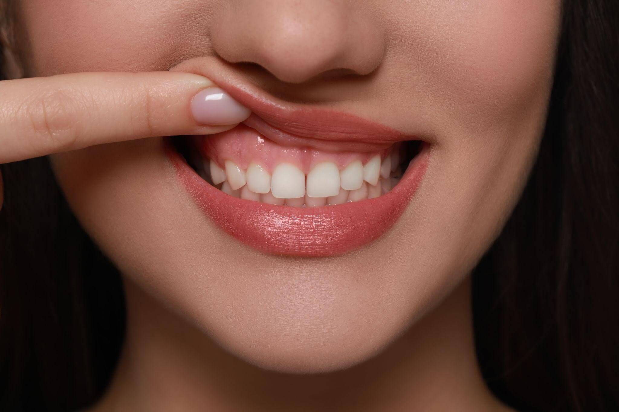 Gum Disease: Causes, Stages, and Risks